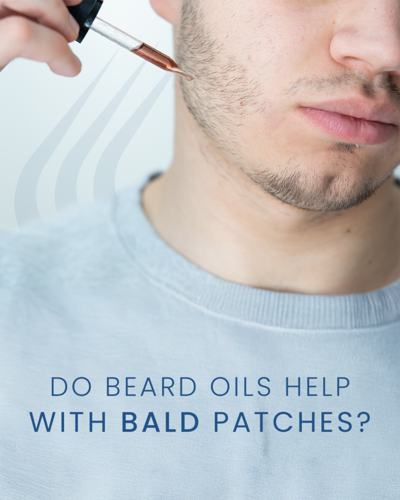 Do beard oils help with bald patches? - Medical Hair Restoration